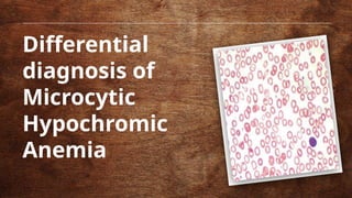 Differential diagnosis of MHC anemia.pptx