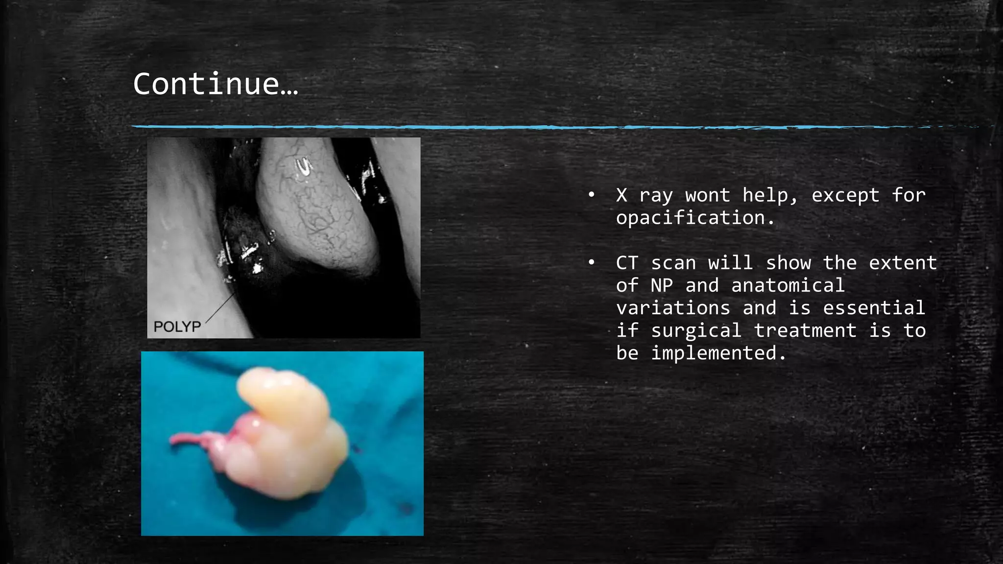 Differential diagnosis of nasal mass | PPTX