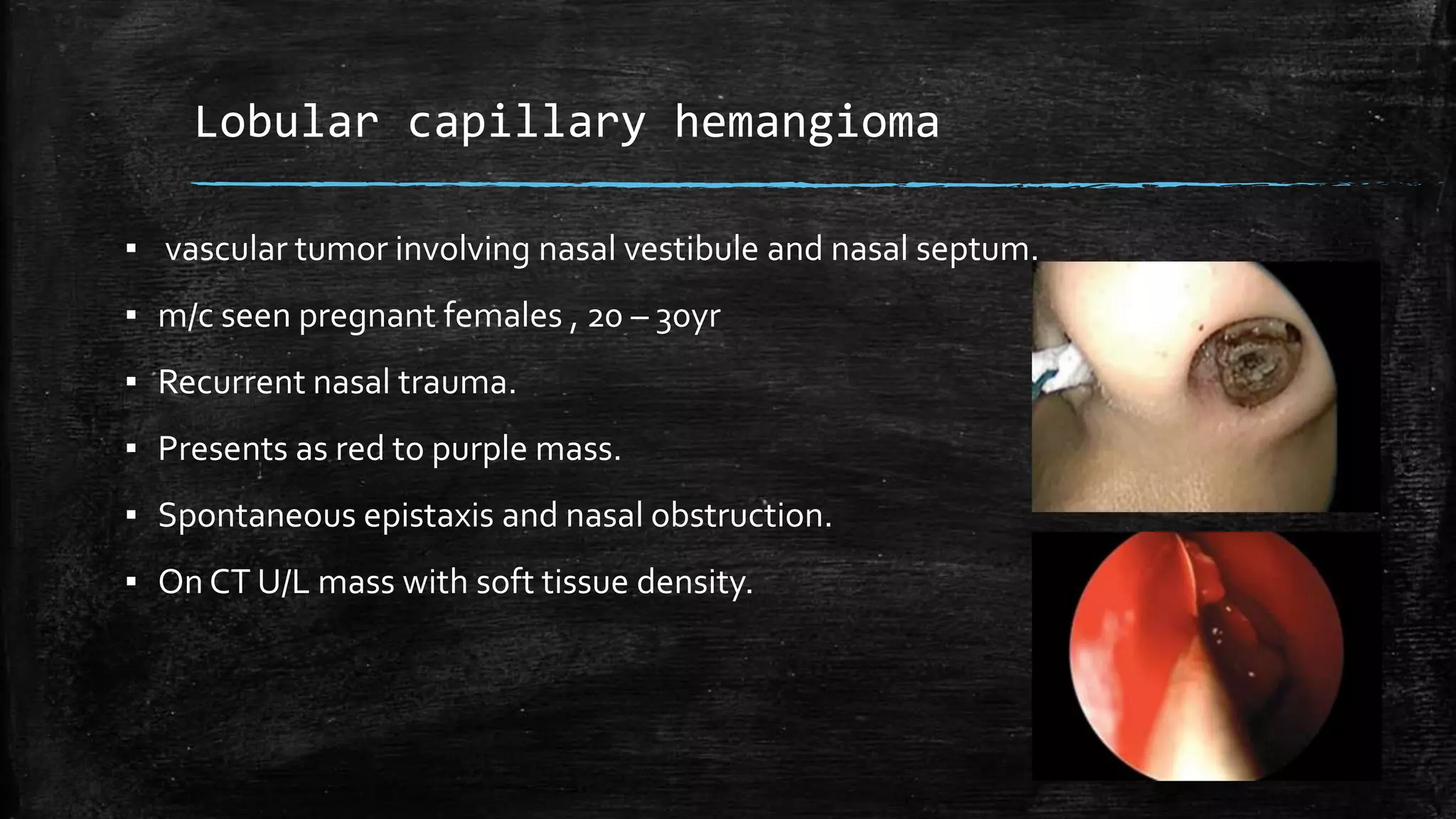 Differential diagnosis of nasal mass | PPTX