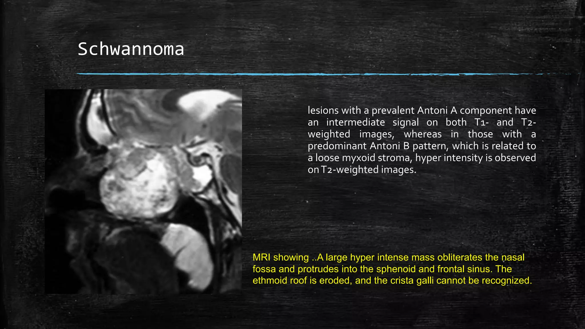 Differential Diagnosis Of Nasal Mass Ppt
