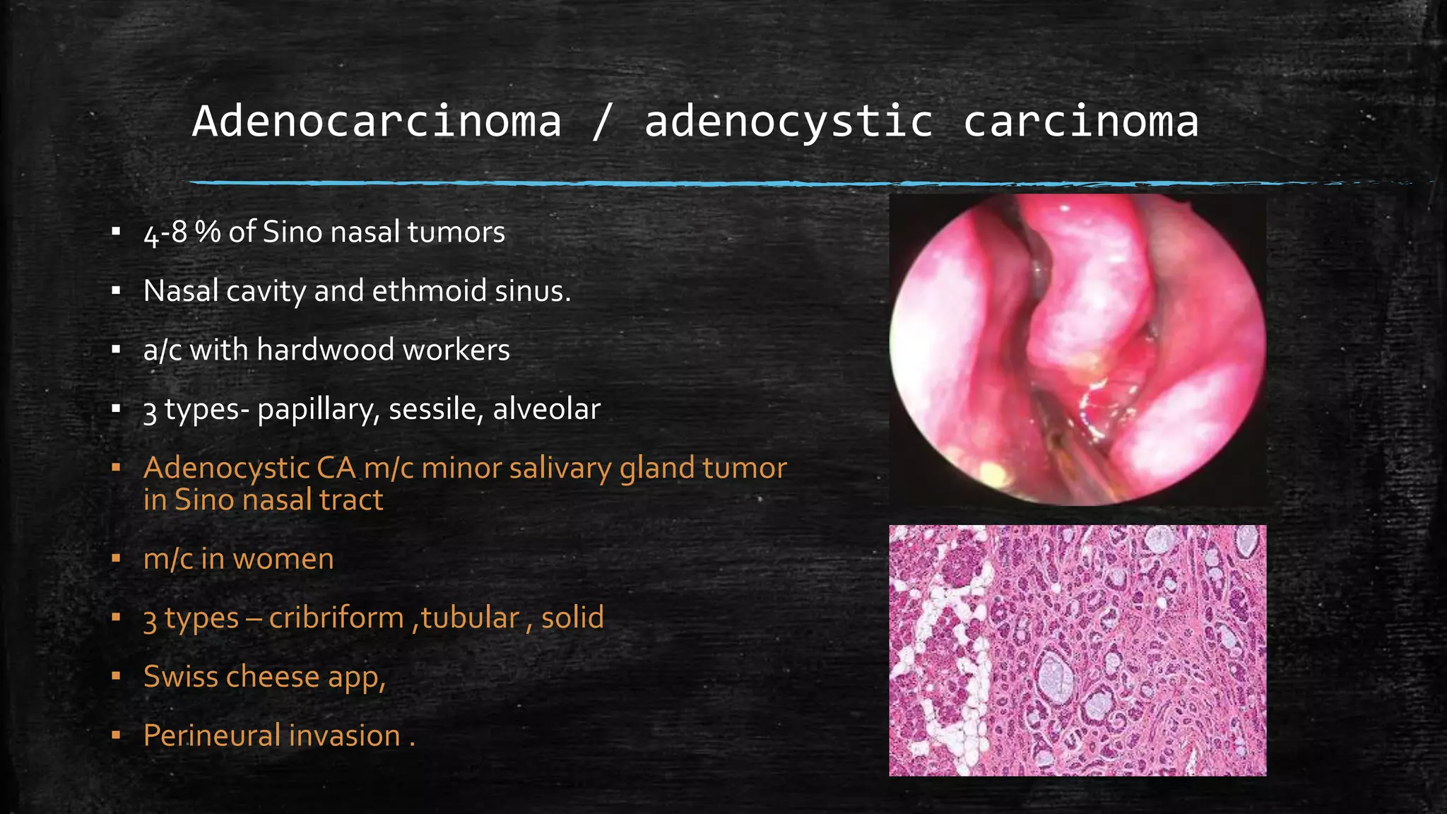 Differential diagnosis of nasal mass | PPTX