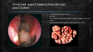 Differential diagnosis of nasal mass | PPTX