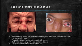 Differential diagnosis of nasal mass | PPTX