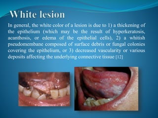 Differential diagnosis of oral and maxillofacial lesions | PPTX