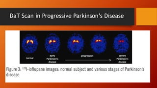 Differential diagnosis of parkinson's disease | PPTX
