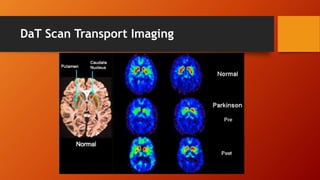 Differential diagnosis of parkinson's disease | PPTX
