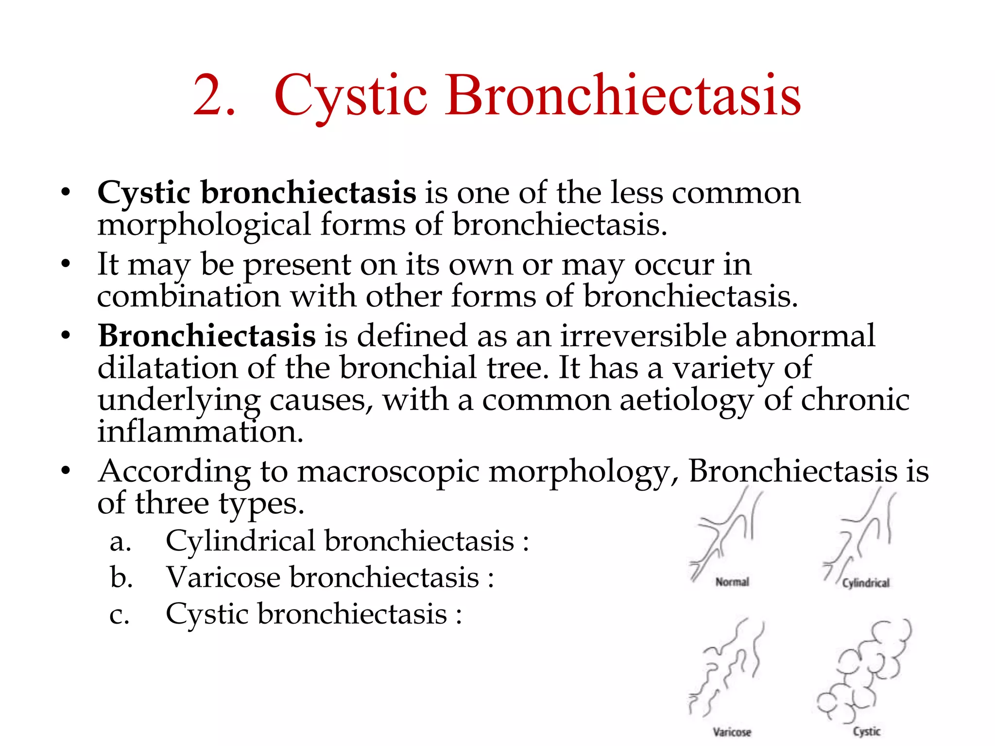 Differential diagnosis of pulmonary cyst: 1. Bullous Emphysema. 2 ...