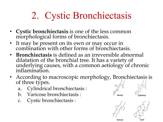 Differential diagnosis of pulmonary cyst: 1. Bullous Emphysema. 2 ...