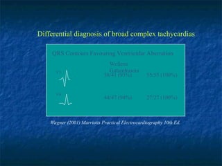 Differential Diagnosis of Tachycardias.ppt