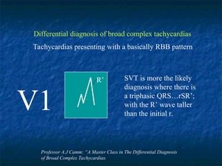 Differential Diagnosis of Tachycardias.ppt