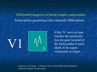 Differential Diagnosis of Tachycardias.ppt