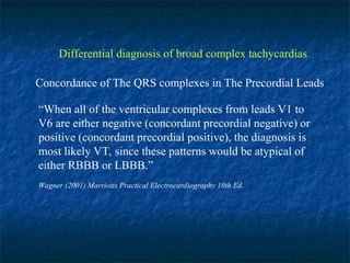 Differential Diagnosis of Tachycardias.ppt