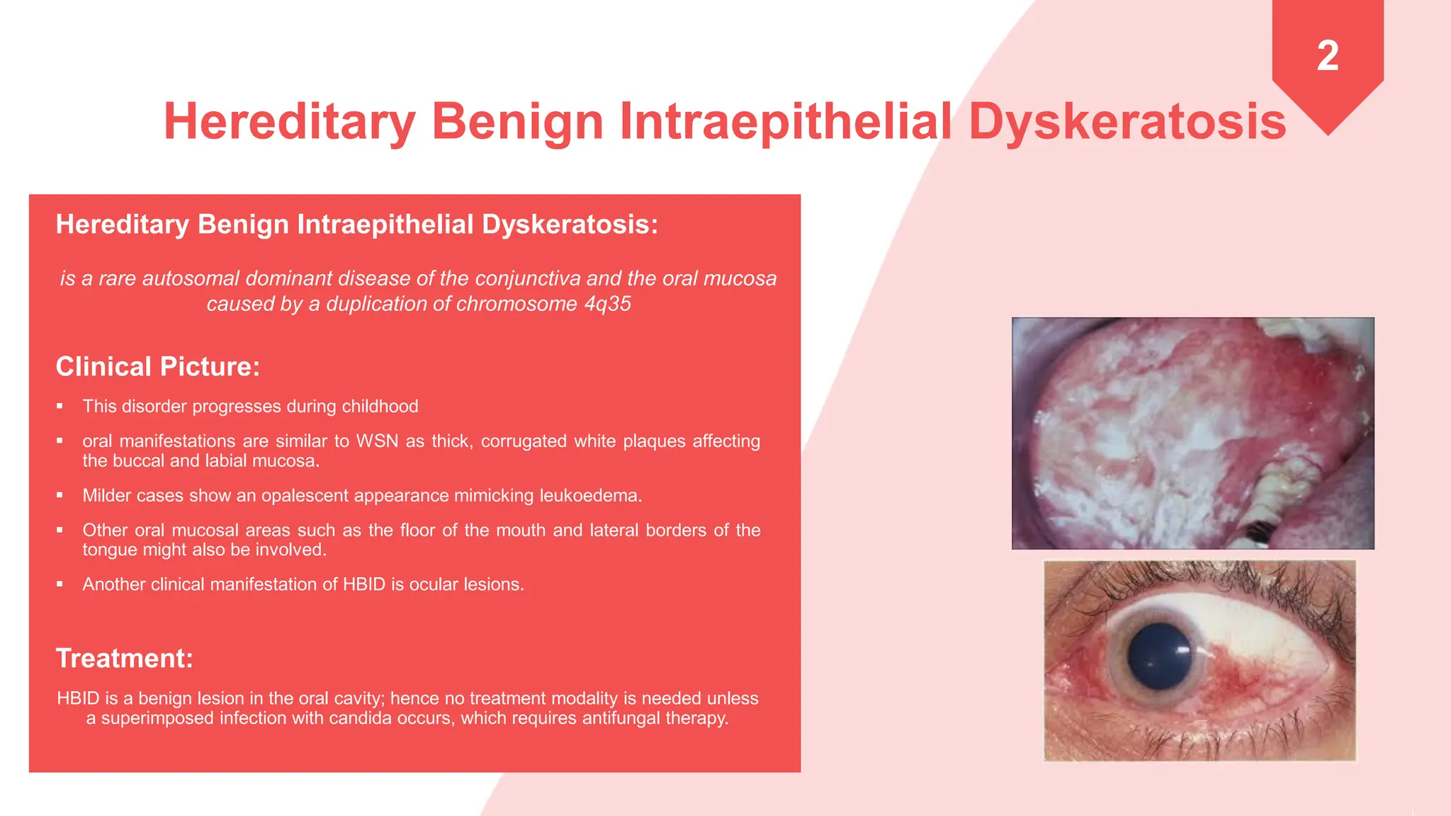 Differential Diagnosis of White Lesions in the oral cavity.pdf