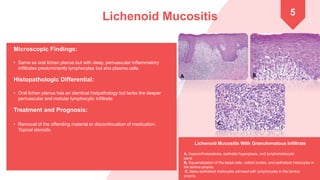 Differential Diagnosis of White Lesions in the oral cavity.pdf