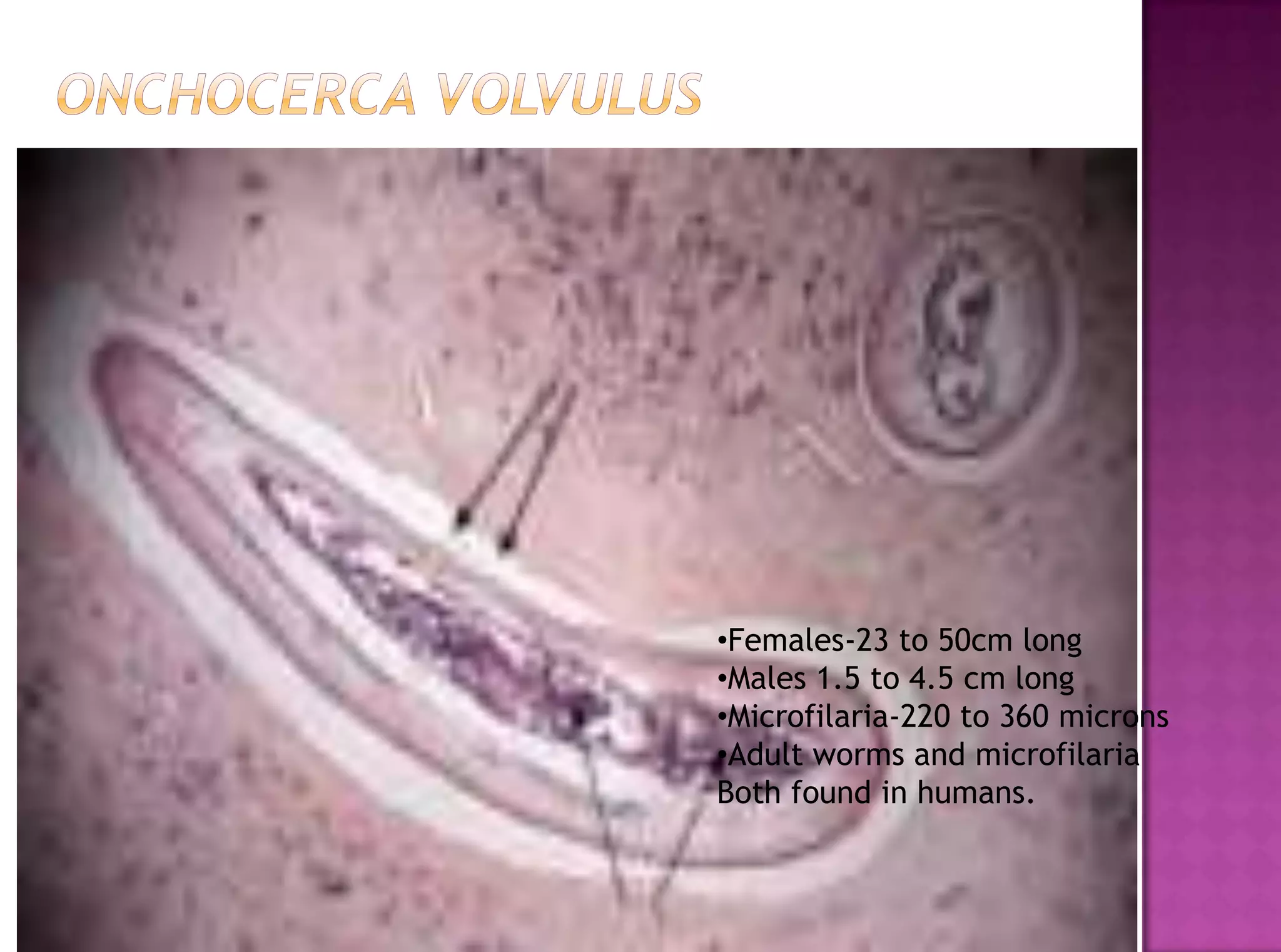 Differential diagnosis of worms in the eye | PPTX