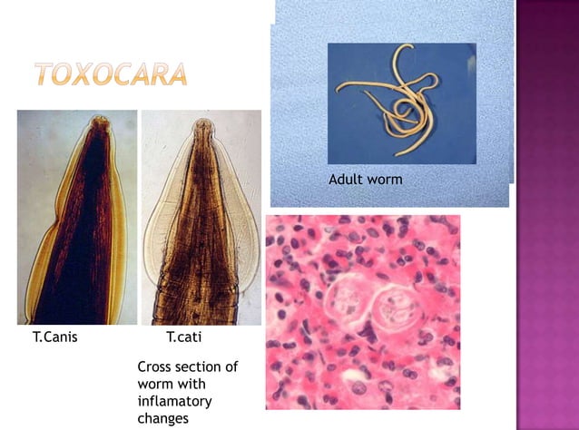 Differential diagnosis of worms in the eye | PPT
