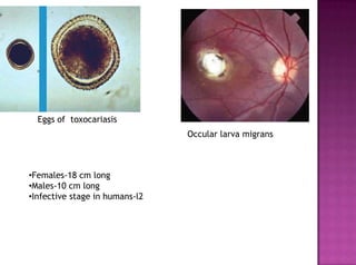 Differential diagnosis of worms in the eye | PPTX