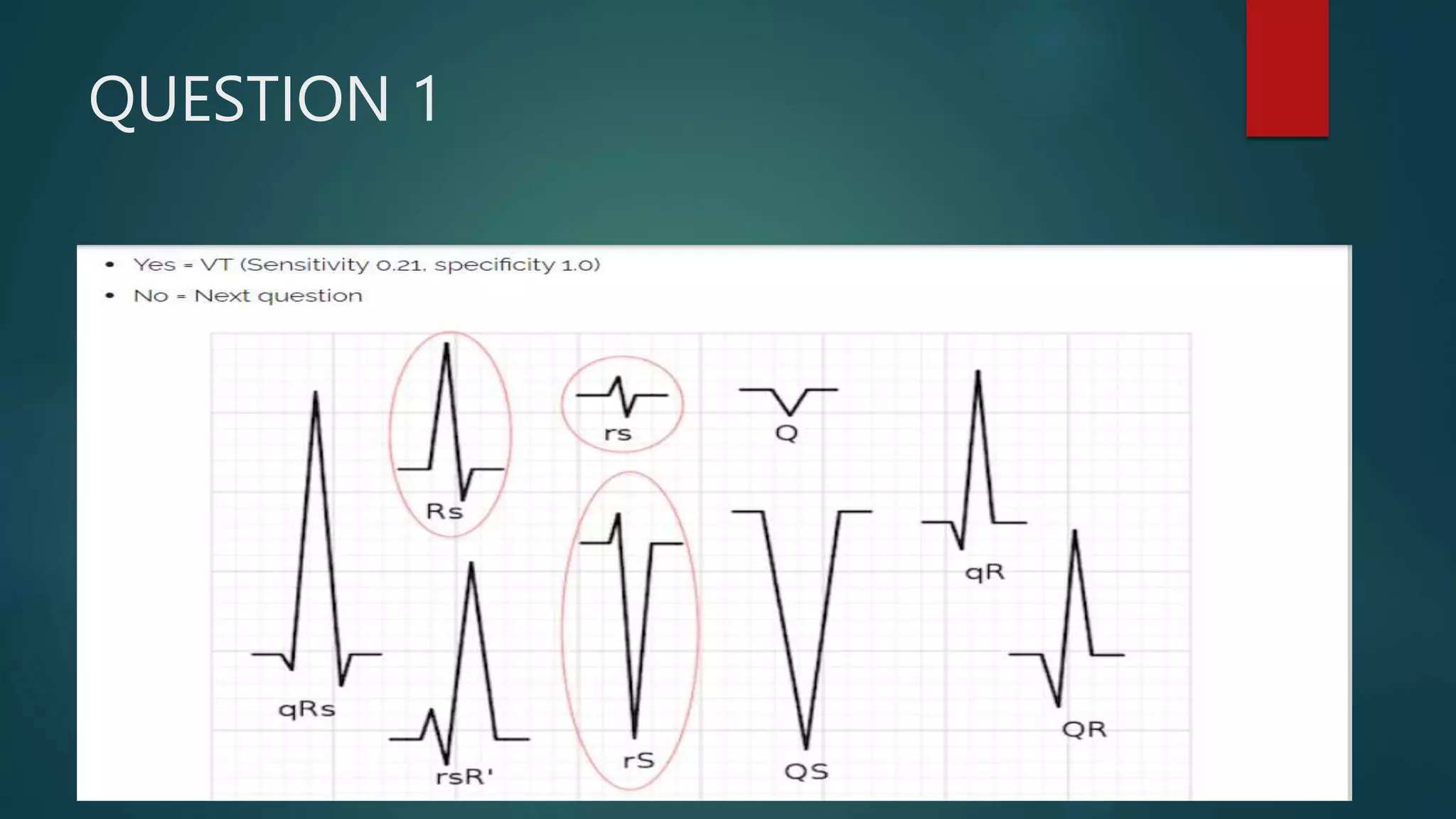 DIFFERENTIALS OF ARRYTHMIAS WITH RBBB MORPHOLOGY.pptx