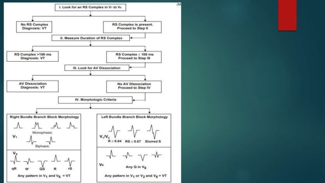 DIFFERENTIALS OF ARRYTHMIAS WITH RBBB MORPHOLOGY.pptx