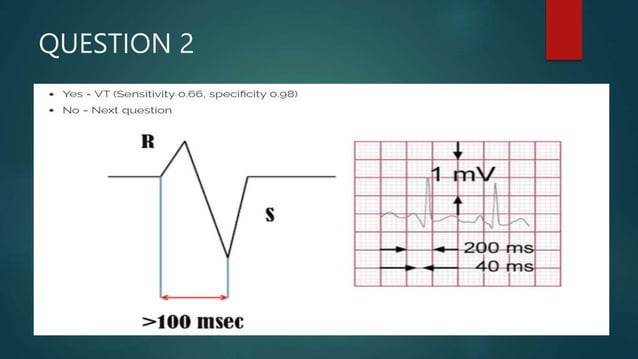 DIFFERENTIALS OF ARRYTHMIAS WITH RBBB MORPHOLOGY.pptx