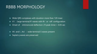 DIFFERENTIALS OF ARRYTHMIAS WITH RBBB MORPHOLOGY.pptx