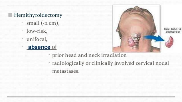 Differentiated thyroid carcinoma