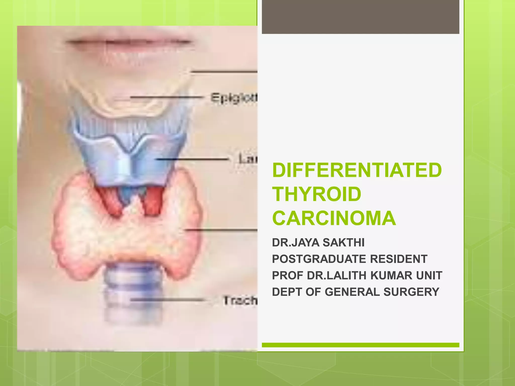 Differentiated thyroid carcinoma | PPT