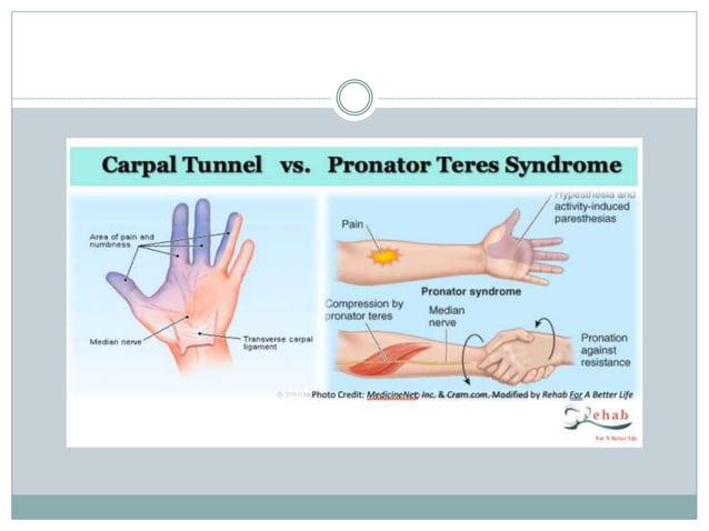 Differentiate Pronator Teres Syndrome and Carpal Tunnel Syndrome.pptx