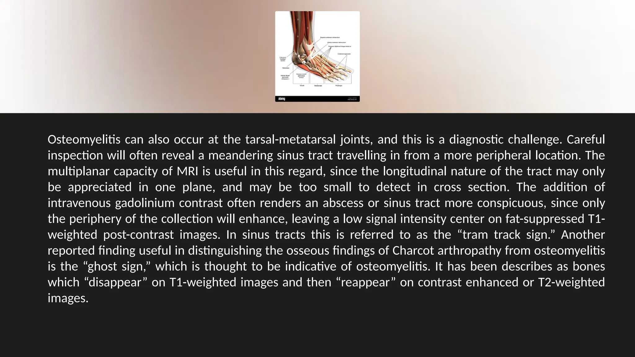 Differentiating-Charcots-Arthropathy-from-Osteomyelitis PPT.pptx