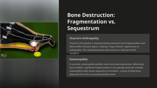 Differentiating-Charcots-Arthropathy-from-Osteomyelitis PPT.pptx