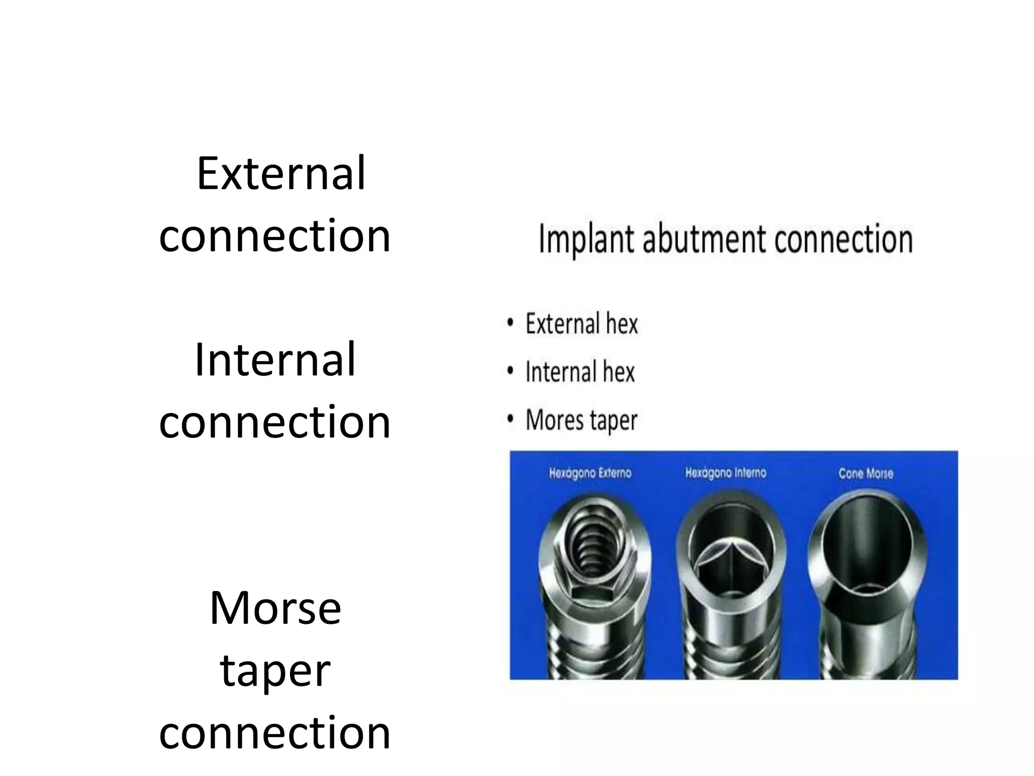 Different implant abutment connections | PPTX
