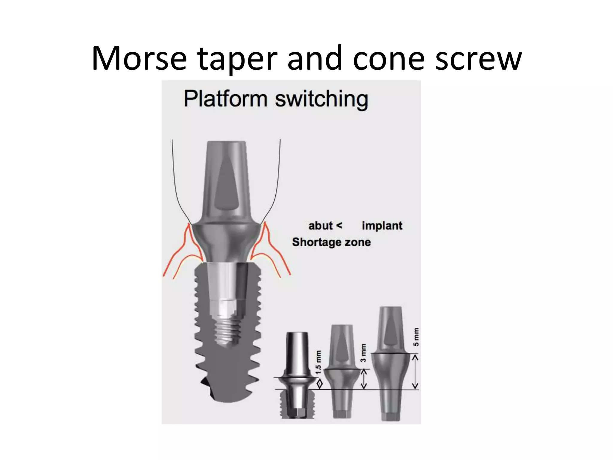 Different implant abutment connections | PPTX