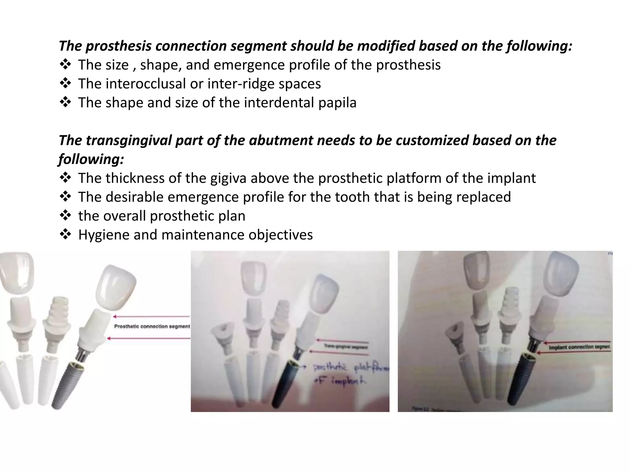 Different implant abutment connections | PPTX