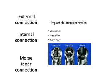 Different implant abutment connections | PPTX