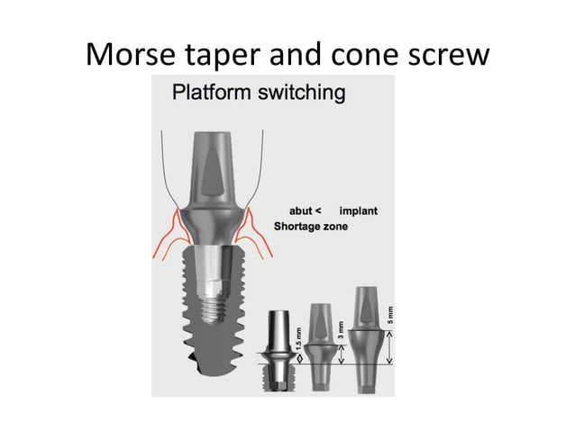 Different implant abutment connections | PPTX | Dental Health ...