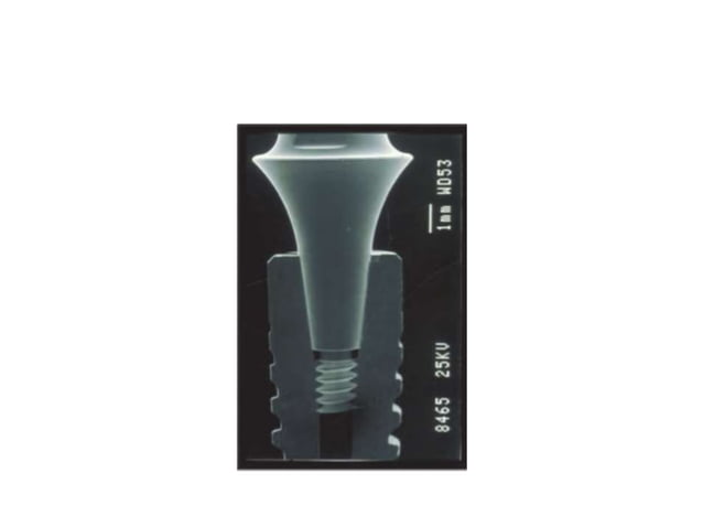 Different implant abutment connections | PPTX | Dental Health ...
