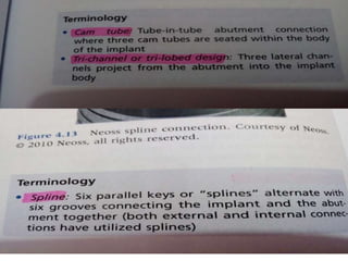 Different implant abutment connections | PPTX