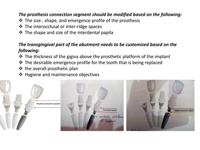 Different implant abutment connections | PPTX | Dental Health ...