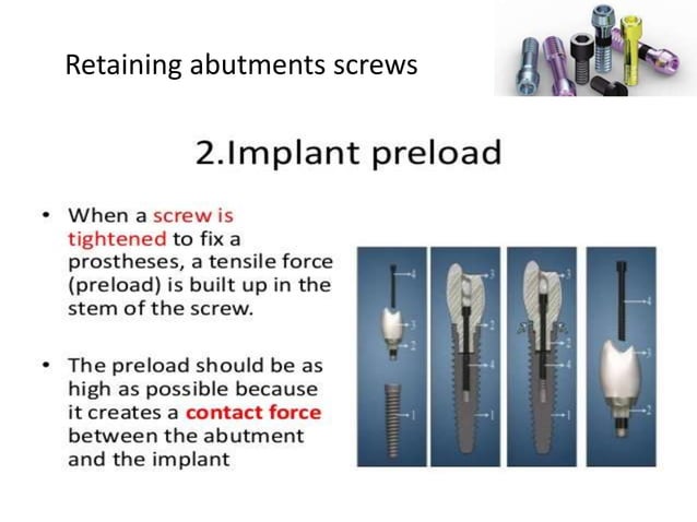 Different implant abutment connections | PPTX | Dental Health ...
