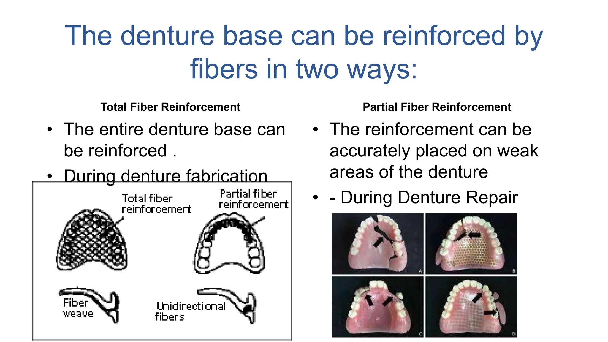 Different materials used in denture base reinforcement in case of ...
