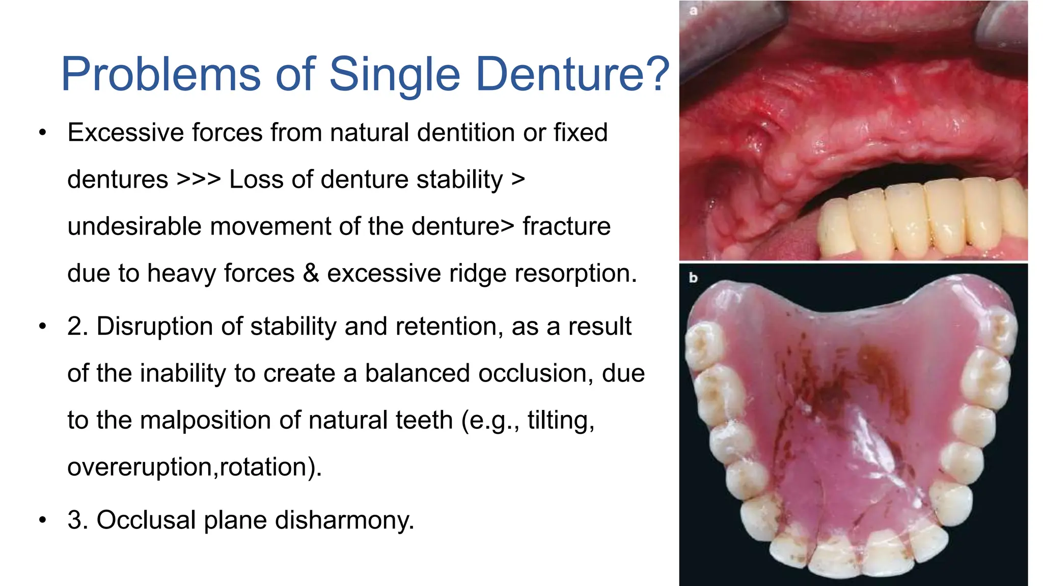 Different materials used in denture base reinforcement in case of single denture .pptx