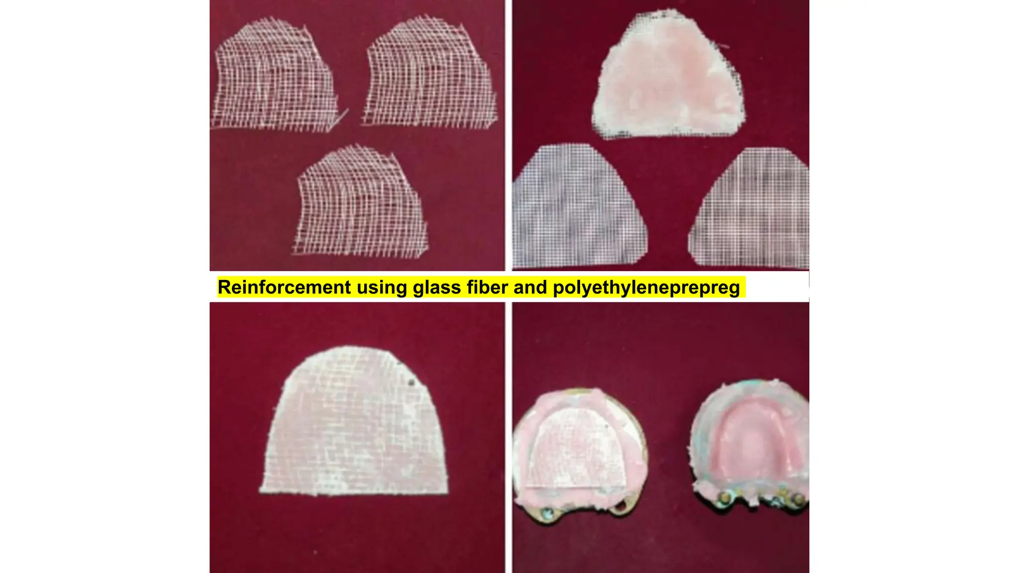 Different materials used in denture base reinforcement in case of ...