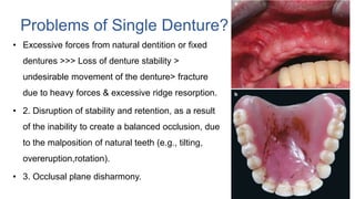 Different materials used in denture base reinforcement in case of ...
