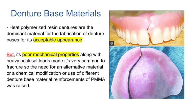 Different materials used in denture base reinforcement in case of ...