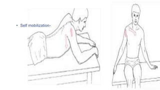 frozen shoulder/adhessive capsulitis/PA | PPT