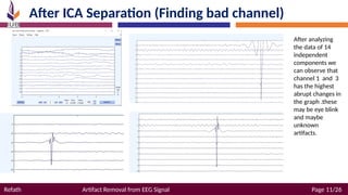 Different Signal Processing Techniques used in Artifact removal from ...