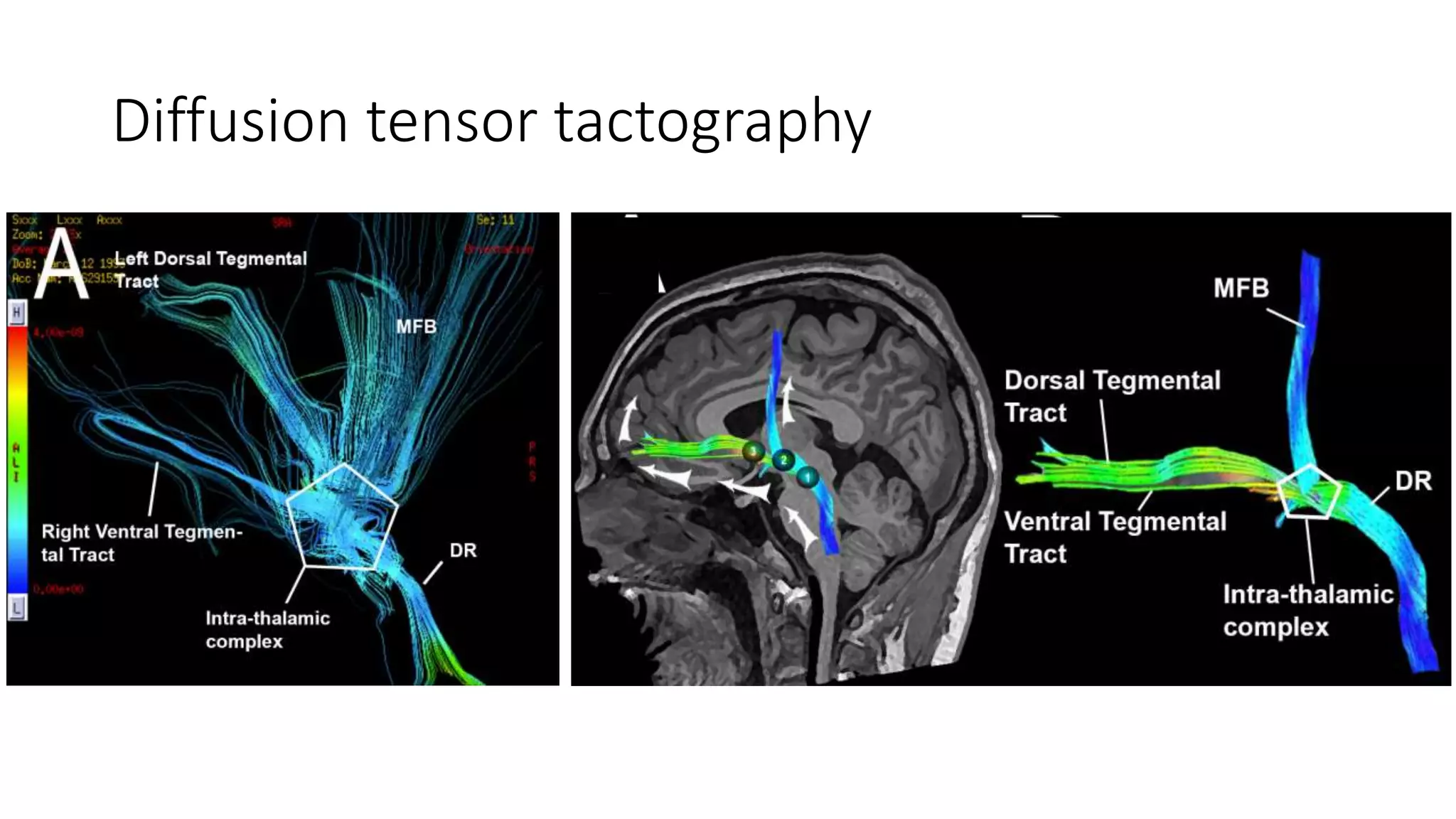 Different states of unconsciousness | PPT