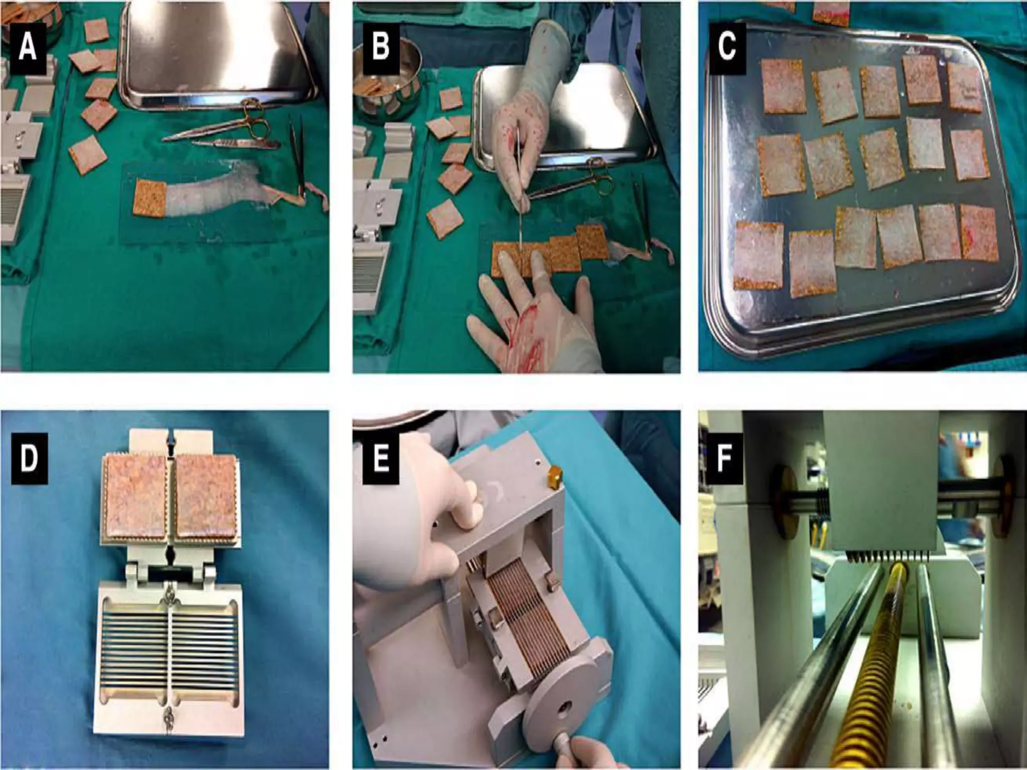 Different technique in skin grafting | PPTX
