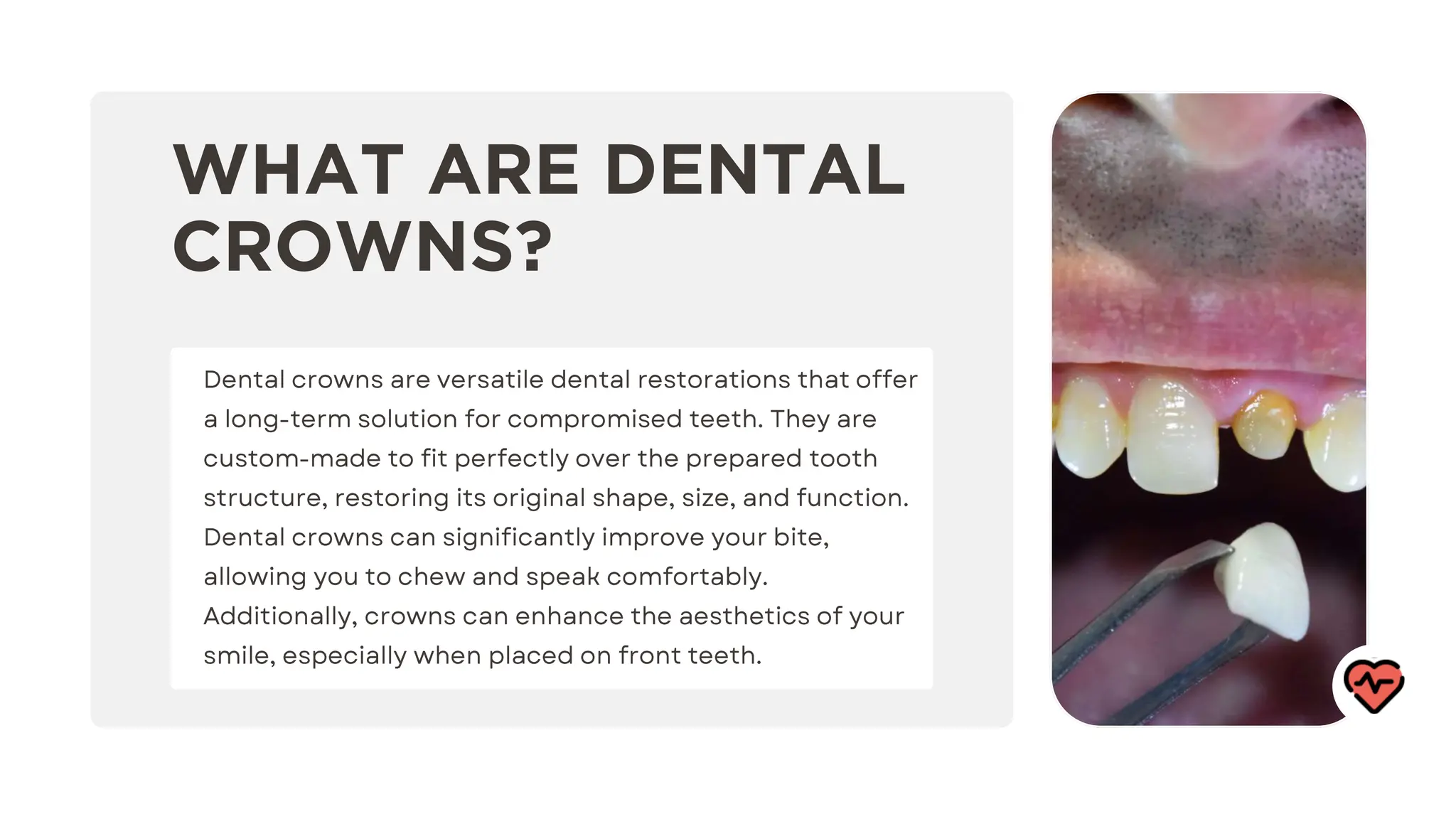 Understanding Different Type of Dental Crowns.pptx
