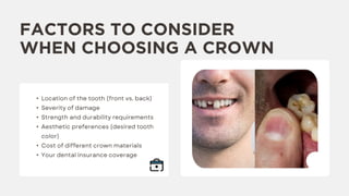 Understanding Different Type of Dental Crowns.pptx